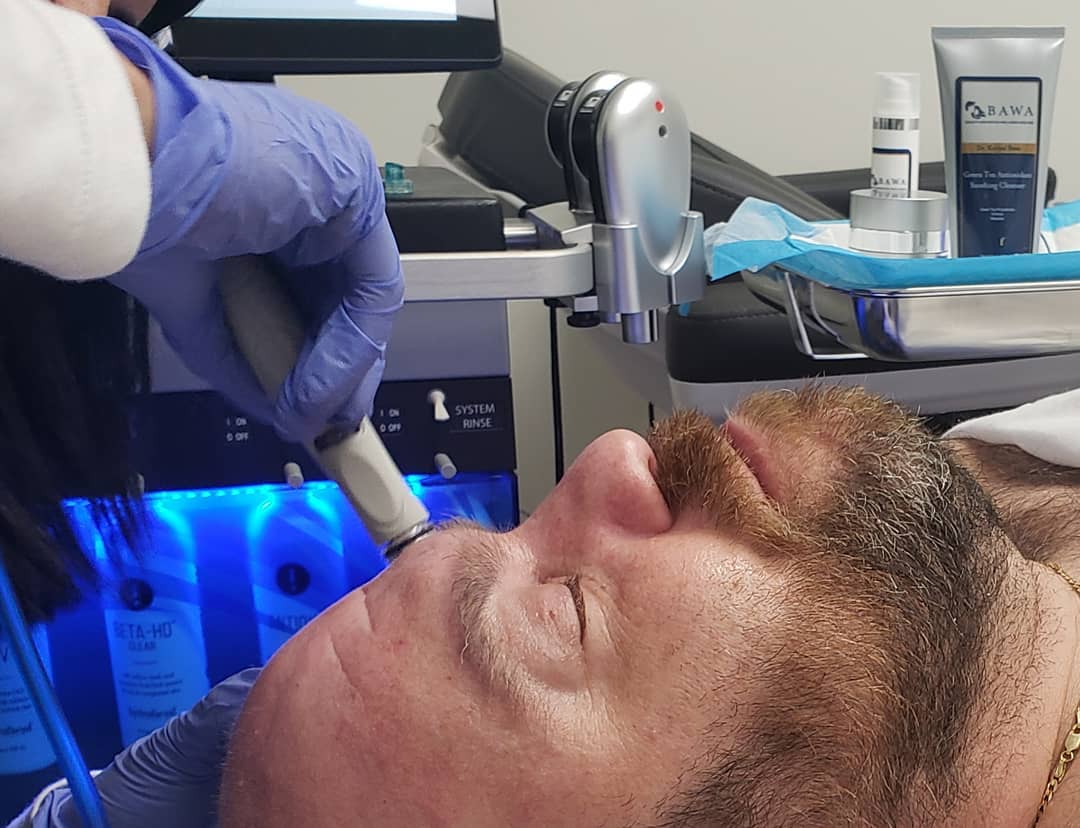 What is HydraFacial®? – Bawa Medical